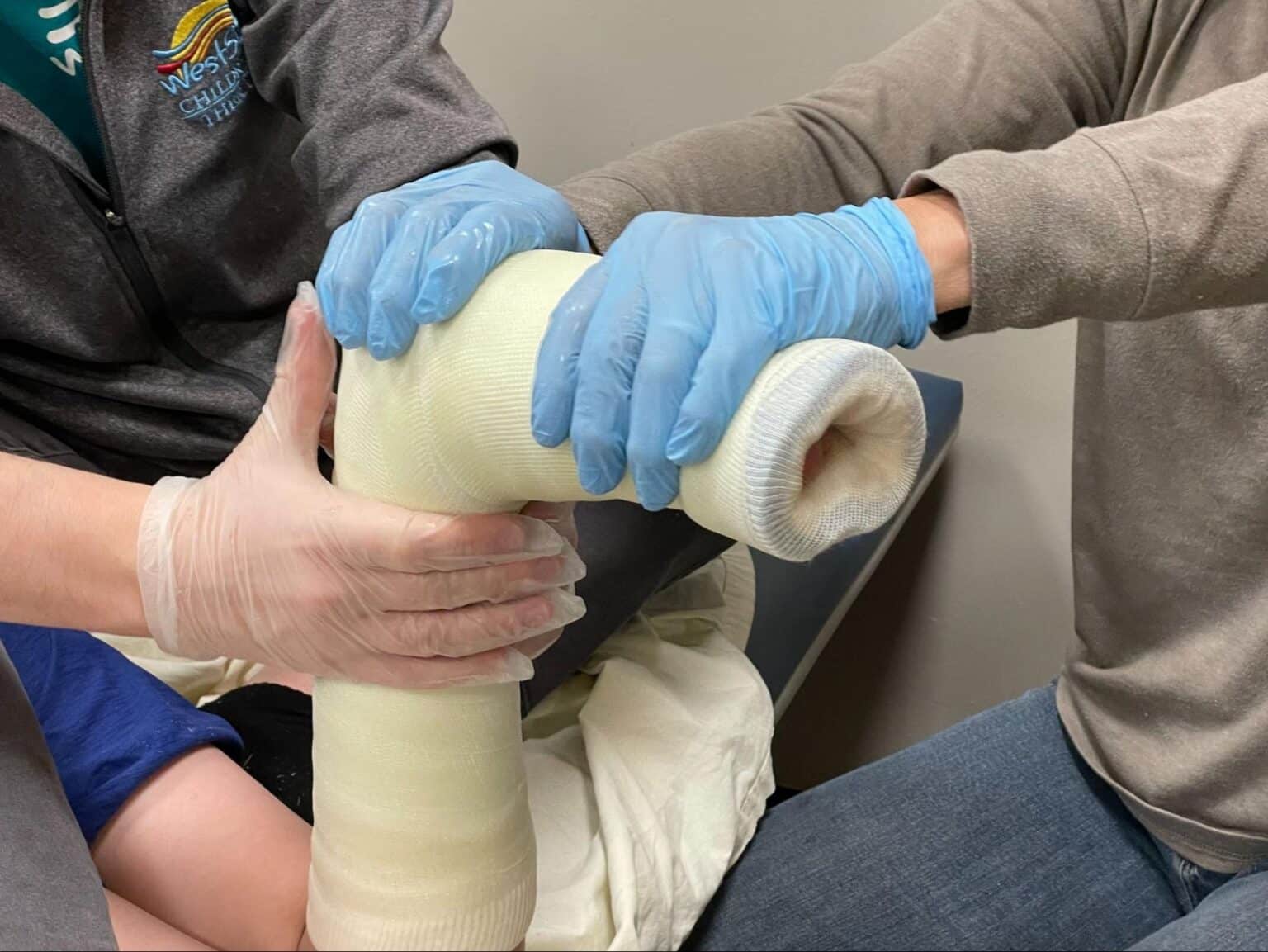 Serial Casting | Pediatric Physical Therapy In Illinois