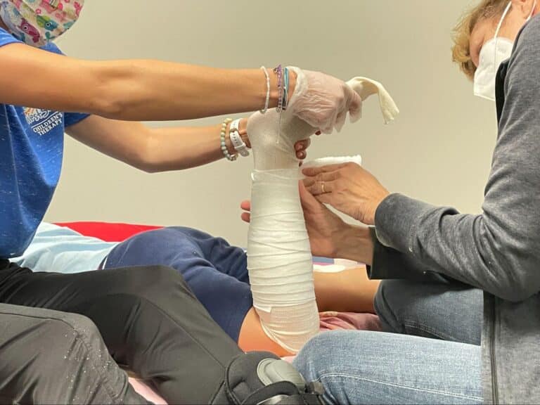 What is Serial Casting & How Can It Help My Child?