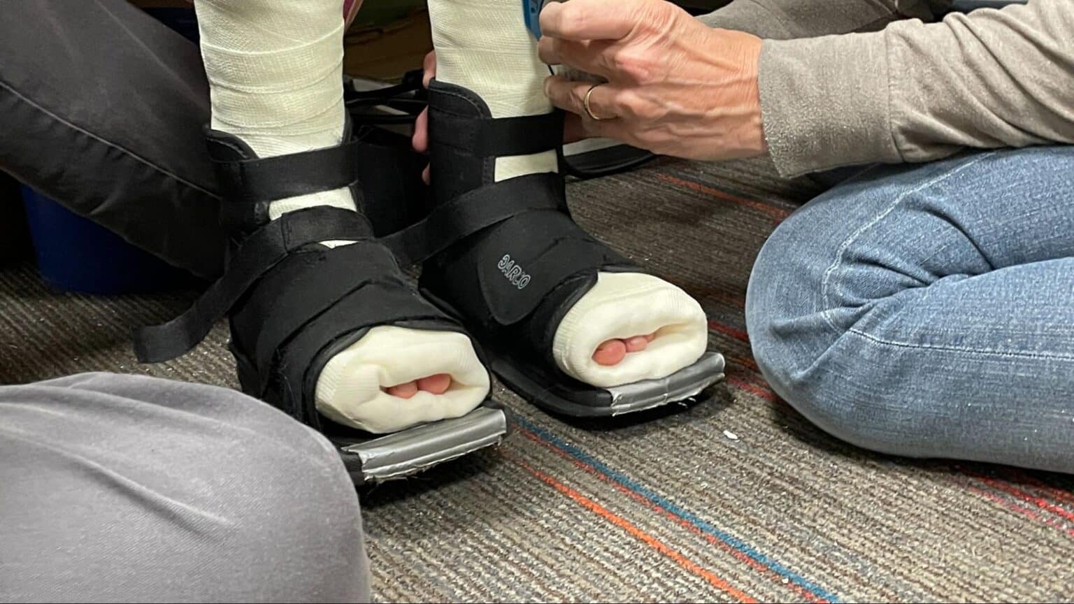 What Is Serial Casting & How Can It Help My Child?